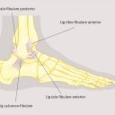 Fotledsdistorsion - Ortopedboken